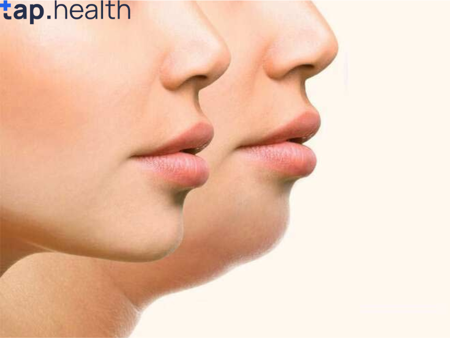 5 Incredible Ways to Get Rid of Face Fat for Hiccups