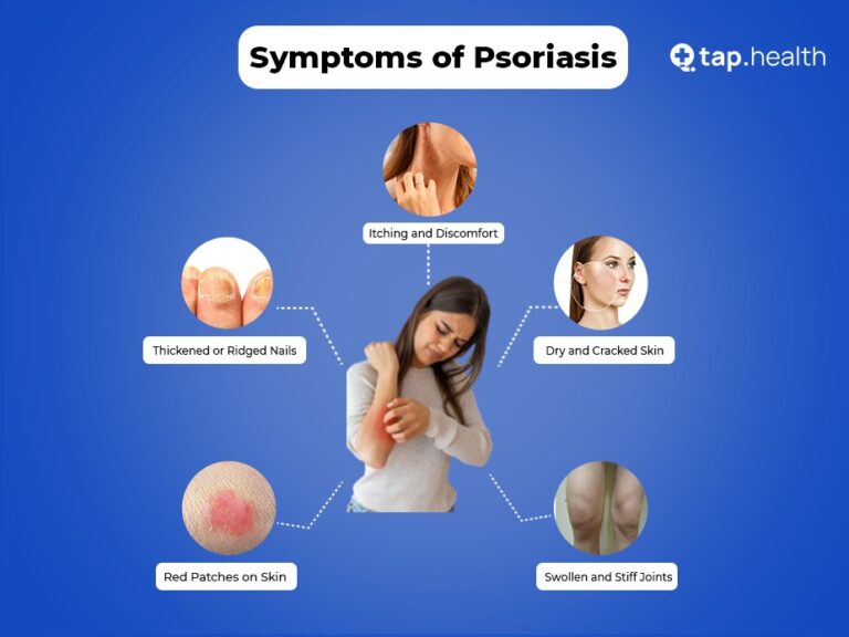 What are Psoriasis Symptoms and Causes? - Tap Health