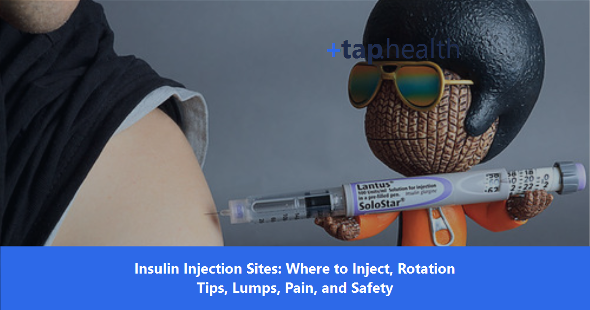 Insulin Injection Sites and Rotation Tips
